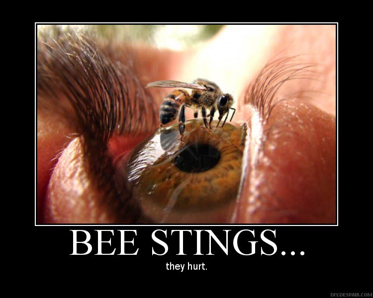Bee Stings